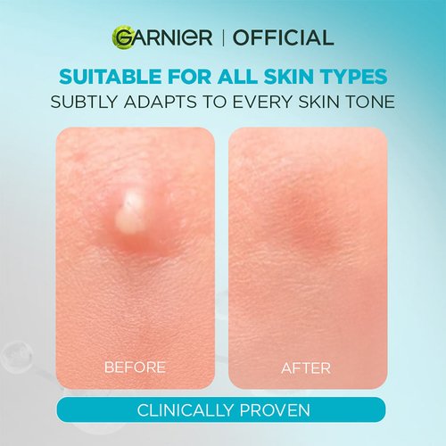 Garnier Invisible Pimple Patch (22s)
