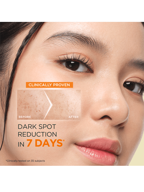 Garnier Bright Complete | Garnier Bright Complete Vitamin C Water Gel